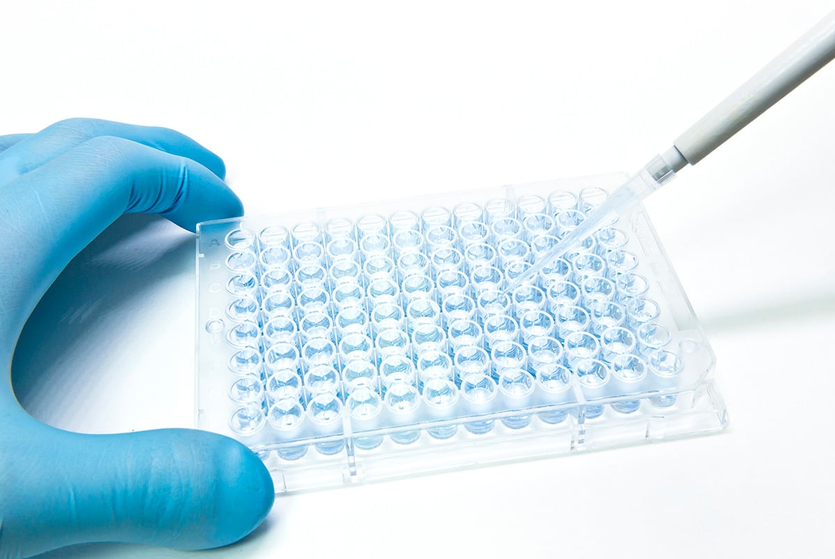 Multiplex Luminex Assay Services | Champions Oncology