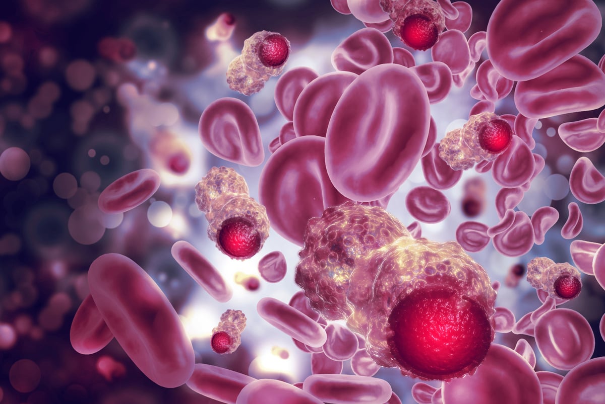 Lymphoma | Myeloma | Leukemia Xenograft Tumor Models